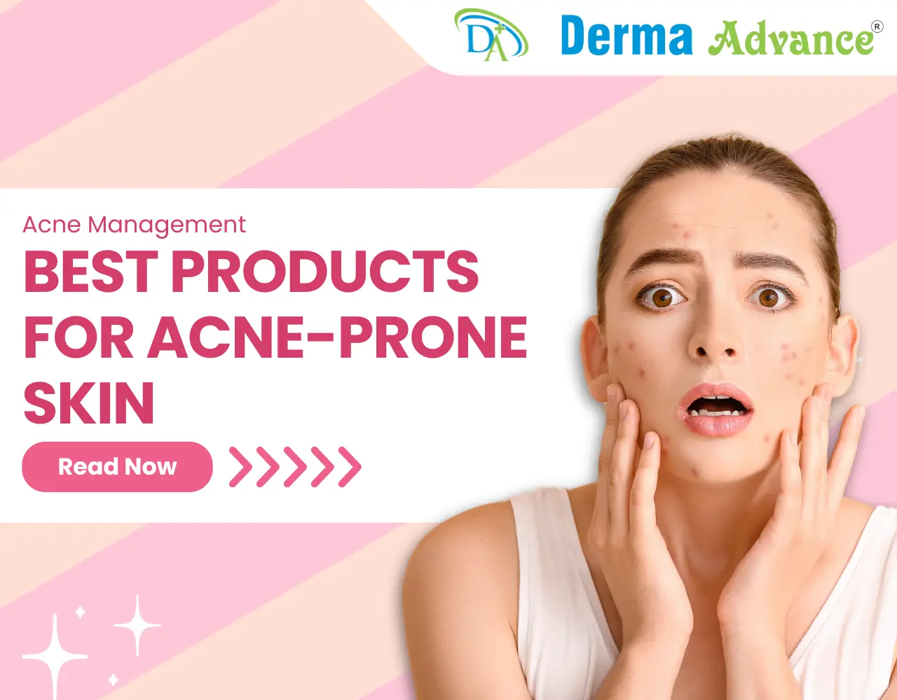 Best Products for Acne-Prone Skin - Derma Advance