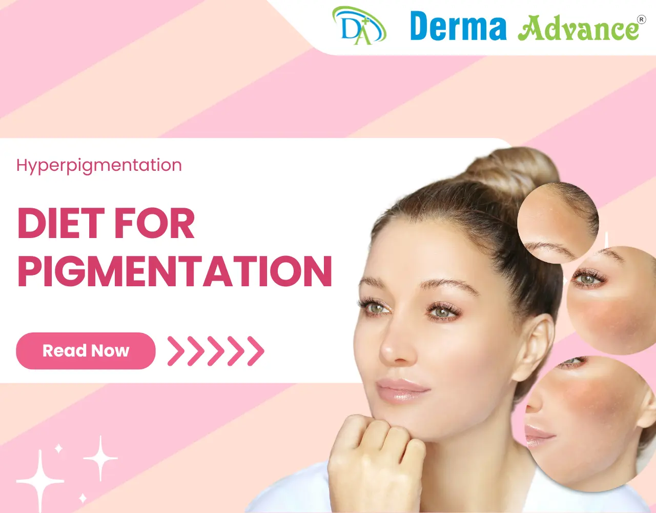 Diet for Pigmentation: A Global Nutritional Guide