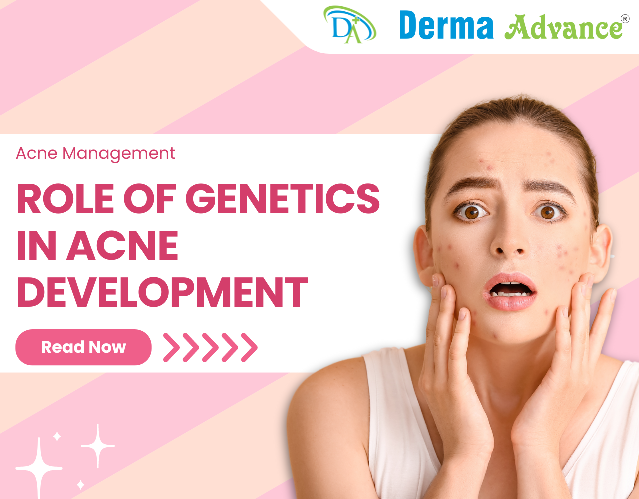 Role of Genetics in Acne - Derma Advance